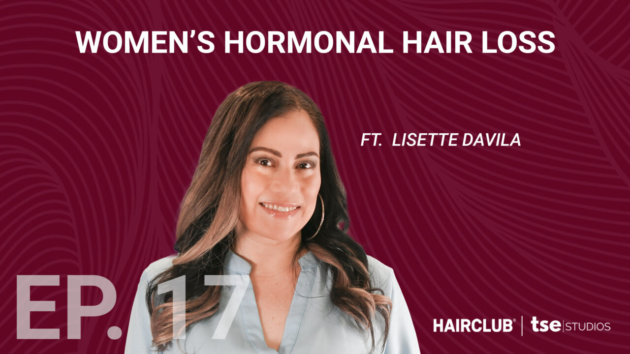 Hormonal Hair Loss In Women Causes And Treatments